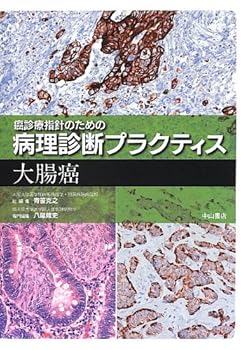 【中古】（良い）大腸癌 (癌診療指針のための病理診断プラクティス)【メーカー名】【メーカー型番】【ブランド名】【商品説明】大腸癌 (癌診療指針のための病理診断プラクティス)画像はイメージ写真ですので付属品など画像の通りではないこともございま...