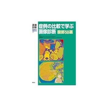 【中古】(良い)症例の比較で学ぶ画像診断腹部50選 (28-4) (画像診断 08年臨時増刊号)【メーカー名】【メーカー型番】【ブランド名】【商品説明】症例の比較で学ぶ画像診断腹部50選 (28-4) (画像診断 08年臨時増刊号)画像はイ...