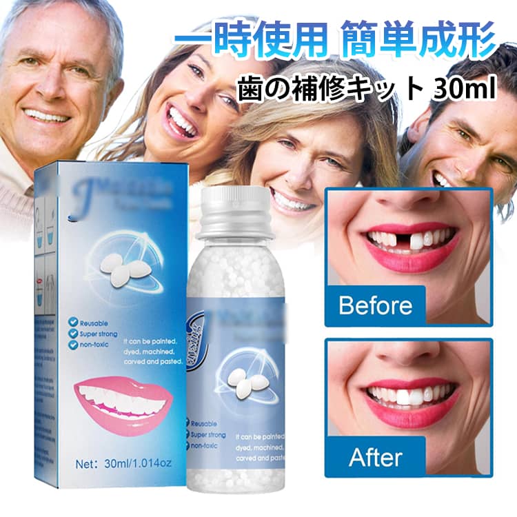 【一時的な歯の補修に】欠けた歯やすき間が気になるときに、応急的にカバーできる補修キット。見た目を自然に整えたい場面や、外出時のエチケット対策としても便利です。【お湯で簡単カスタマイズ】ぬるま湯に入れると柔らかくなり、自由に形を整えることが可...
