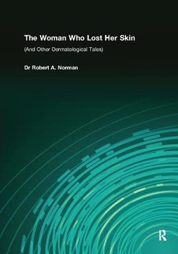 【中古】【未使用・未開封品】The Woman Who Lost Her Skin: (And Other Dermatological Tales)【メーカー名】【メーカー型番】【ブランド名】Routledge Health Care D...