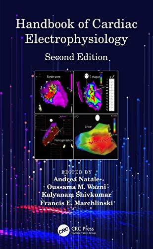 【中古】【未使用・未開封品】Handbook of Cardiac Electrophysiology【メーカー名】【メーカー型番】【ブランド名】CRC Press Surgery, Cardiology, Thoracic & Vascu...