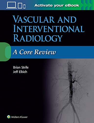 【中古】【未使用・未開封品】Vascular and Interventional Radiology: A Core Review【メーカー名】【メーカー型番】【ブランド名】LWW Radiologic & Ultrasound Tech...