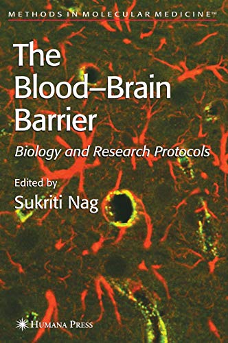 【中古】【未使用・未開封品】Blood'Brain Barrier: Biology and Research Protocols (Methods in Molecular Medicine, 89)【メーカー名】【メーカー型番】【ブラン...