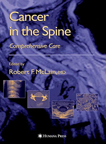 【中古】【未使用・未開封品】Cancer in the Spine: Comprehensive Care (Current Clinical Oncology)【メーカー名】【メーカー型番】【ブランド名】Humana Surgery, N...