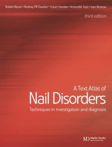 【中古】【未使用・未開封品】A Text Atlas of Nail Disorders: Techniques in Investigation and Diagnosis【メーカー名】【メーカー型番】【ブランド名】CRC Press S...