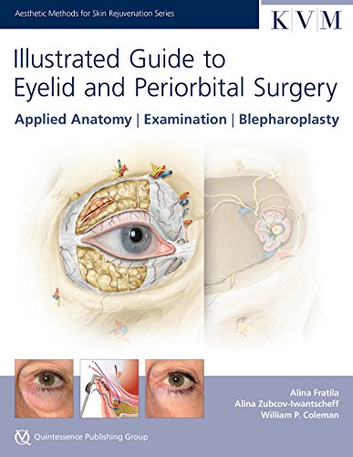 【中古】【未使用・未開封品】Illustrated Guide to Eyelid and Periorbital Surgery: Applied Anatomy, Examination, Blepharoplasty (Aesthet...