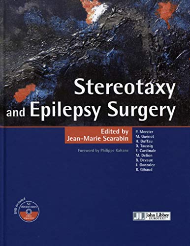 【中古】【未使用・未開封品】Stereotaxy & Epilepsy Surgery【メーカー名】【メーカー型番】【ブランド名】【商品説明】Stereotaxy & Epilepsy Surgery【注意】こちらは輸入品となります。当店で...