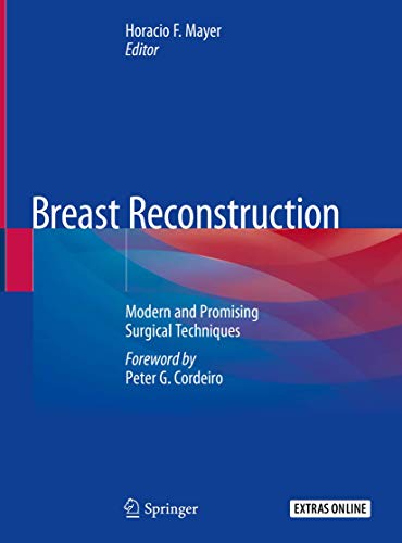 【中古】【未使用・未開封品】Breast Reconstruction: Modern and Promising Surgical Techniques【メーカー名】【メーカー型番】【ブランド名】Springer Surgery, Pla...