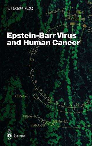 【中古】【未使用・未開封品】Epstein-Barr Virus and Human Cancer (Current Topics in Microbiology & Immunology)【メーカー名】【メーカー型番】【ブランド名】Spr...
