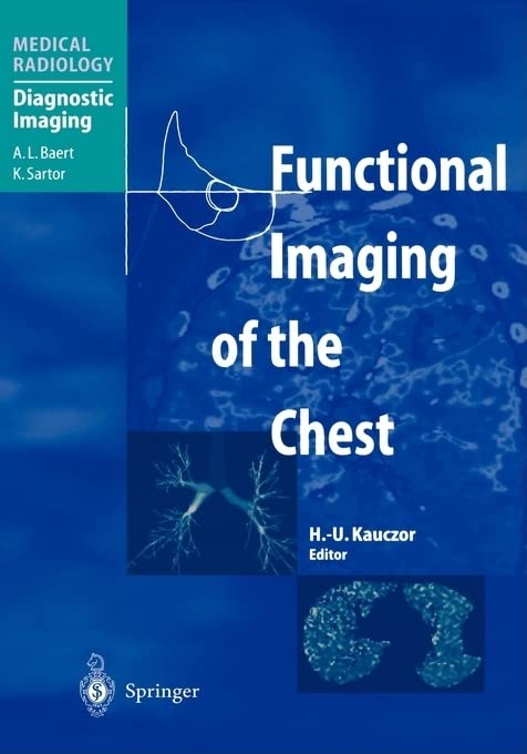 【中古】【未使用・未開封品】Functional Imaging of the Chest (Medical Radiology)【メーカー名】【メーカー型番】【ブランド名】Springer Internal Medicine, Speci...