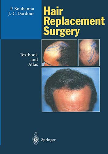 【中古】【未使用・未開封品】Hair Replacement Surgery: Textbook and Atlas【メーカー名】【メーカー型番】【ブランド名】【商品説明】Hair Replacement Surgery: Textbook...