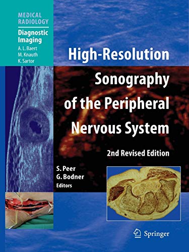 【中古】【未使用・未開封品】High-Resolution Sonography of the Peripheral Nervous System (Medical Radiology)【メーカー名】【メーカー型番】【ブランド名】Sprin...