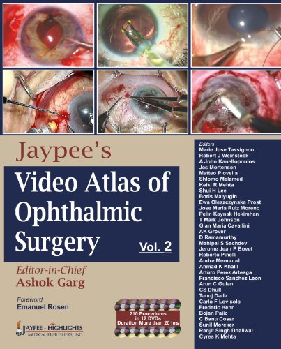 【中古】【未使用・未開封品】Jaypee's Video Atlas of Ophthalmic Surgery【メーカー名】【メーカー型番】【ブランド名】【商品説明】Jaypee's Video Atlas of Ophthalmic S...
