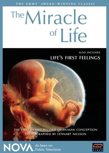 【中古】【未使用・未開封品】Nova: Miracle of Life & Life's First Feelings [DVD] [Import]【メーカー名】【メーカー型番】【ブランド名】【商品説明】Nova: Miracle of L...