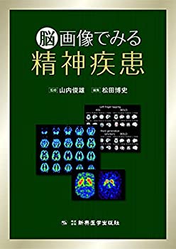【状態】中古品（非常に良い）【メーカー名】新興医学出版社【メーカー型番】【ブランド名】掲載画像は全てイメージです。実際の商品とは色味等異なる場合がございますのでご了承ください。【 ご注文からお届けまで 】・ご注文　：ご注文は24時間受け付け...
