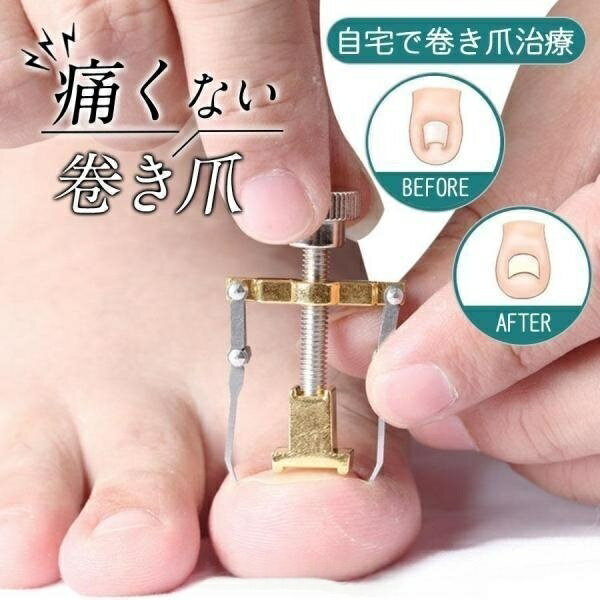 商品詳細:カラー:/シルバーサイズ:/フリーサイズ・痛くない自分でできる・加工不要の新しい巻き爪・陥入爪の矯正治療・折り曲げ・接着などの加工がなく耐久性ありステンレス製※巻き爪の程度がひどい場合には使用できません。※爪水虫等の爪の疾患や爪周...