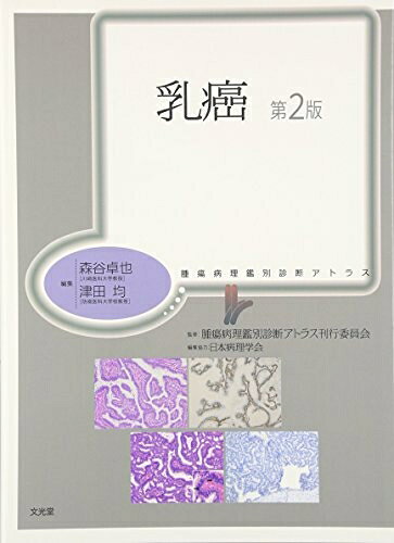 【商品名】乳癌 (腫瘍病理鑑別診断アトラス)（中古品）中古本の特性上【ヤケ、破れ、折れ、メモ書き、匂い】等がある場合がございます。特に状態が【可】の場合は書き込みや破れがある場合がございますので予めご承知おきのほどよろしくお願いいたします。...