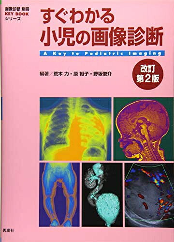 【商品名】すぐわかる小児の画像診断 改訂第2版 (画像診断別冊KEYBOOKシリーズ)（中古品）中古本の特性上【ヤケ、破れ、折れ、メモ書き、匂い】等がある場合がございます。特に状態が【可】の場合は書き込みや破れがある場合がございますので予め...