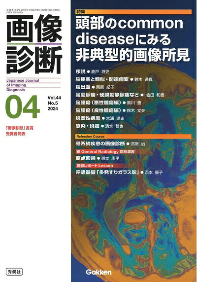 【商品名】画像診断2024年4月号 Vol.44 No.5: 頭部のCommon diseaseみる非典型的画像所見（中古品）中古本の特性上【ヤケ、破れ、折れ、メモ書き、匂い】等がある場合がございます。特に状態が【可】の場合は書き込みや破れ...