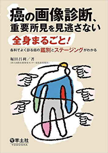 【商品名】癌の画像診断、重要所見を見逃さない〜全身まるごと! 各科でよく診る癌の鑑別とステージングがわかる（中古品）中古本の特性上【ヤケ、破れ、折れ、メモ書き、匂い】等がある場合がございます。特に状態が【可】の場合は書き込みや破れがある場合...