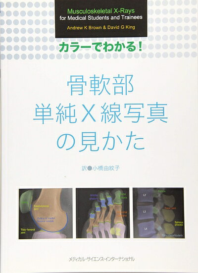 【商品名】カラーでわかる! 骨軟部単純X線写真の見かた（中古品）中古本の特性上【ヤケ、破れ、折れ、メモ書き、匂い】等がある場合がございます。特に状態が【可】の場合は書き込みや破れがある場合がございますので予めご承知おきのほどよろしくお願いい...