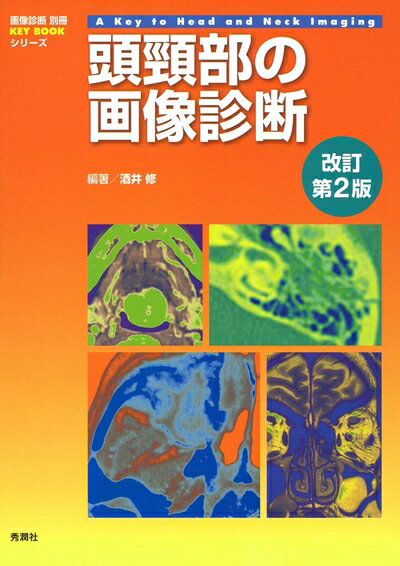 【商品名】頭頸部の画像診断 改訂第2版 (画像診断別冊KEYBOOKシリーズ)（中古品）中古本の特性上【ヤケ、破れ、折れ、メモ書き、匂い】等がある場合がございます。特に状態が【可】の場合は書き込みや破れがある場合がございますので予めご承知お...