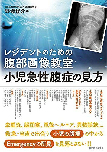 【商品名】レジデントのための腹部画像教室【小児急性腹症の見方】（中古品）中古本の特性上【ヤケ、破れ、折れ、メモ書き、匂い】等がある場合がございます。特に状態が【可】の場合は書き込みや破れがある場合がございますので予めご承知おきのほどよろしく...