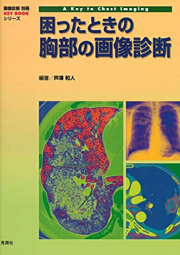 【商品名】困ったときの胸部の画像診断 (画像診断別冊KEY BOOKシリーズ)（中古品）中古本の特性上【ヤケ、破れ、折れ、メモ書き、匂い】等がある場合がございます。特に状態が【可】の場合は書き込みや破れがある場合がございますので予めご承知お...