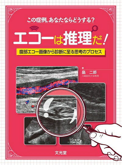 【商品名】エコーは推理だ! 腹部エコー画像から診断に至る思考のプロセス（中古品）中古本の特性上【ヤケ、破れ、折れ、メモ書き、匂い】等がある場合がございます。特に状態が【可】の場合は書き込みや破れがある場合がございますので予めご承知おきのほど...