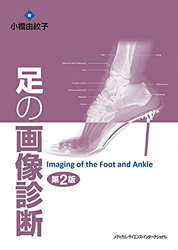 【商品名】足の画像診断 第2版（中古品）中古本の特性上【ヤケ、破れ、折れ、メモ書き、匂い】等がある場合がございます。特に状態が【可】の場合は書き込みや破れがある場合がございますので予めご承知おきのほどよろしくお願いいたします。読む分には問題...