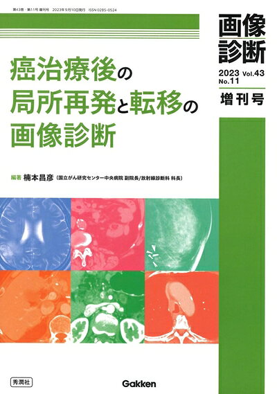 【商品名】画像診断202増刊号Vol.43 No.11: 癌治療後の局所再発と転移の画像診断 (画像診断増刊号 2023(Vol.43 No.11))（中古品）中古本の特性上【ヤケ、破れ、折れ、メモ書き、匂い】等がある場合がございます。特に...