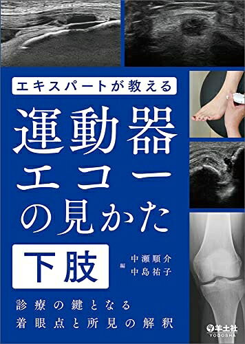 【商品名】エキスパートが教える運動器エコーの見かた　下肢〜診療の鍵となる着眼点と所見の解釈（中古品）中古本の特性上【ヤケ、破れ、折れ、メモ書き、匂い】等がある場合がございます。特に状態が【可】の場合は書き込みや破れがある場合がございますので...