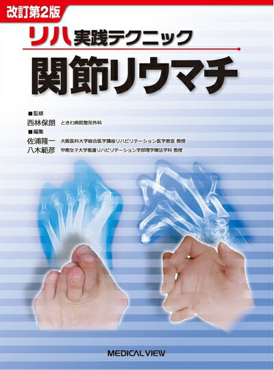 【商品名】関節リウマチ (リハ実践テクニック)（中古品）中古本の特性上【ヤケ、破れ、折れ、メモ書き、匂い】等がある場合がございます。特に状態が【可】の場合は書き込みや破れがある場合がございますので予めご承知おきのほどよろしくお願いいたします...