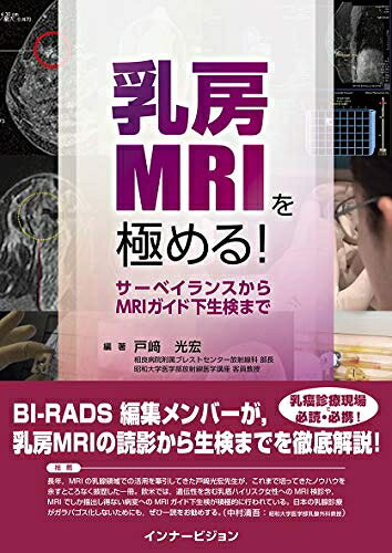 【商品名】乳房MRIを極める! ─サーベイランスからMRIガイド下生検まで─（中古品）中古本の特性上【ヤケ、破れ、折れ、メモ書き、匂い】等がある場合がございます。特に状態が【可】の場合は書き込みや破れがある場合がございますので予めご承知おき...