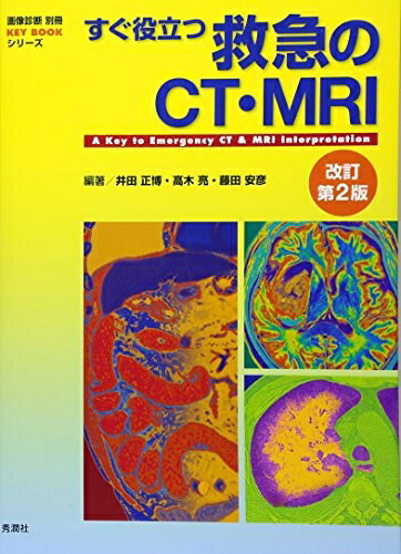 【商品名】すぐ役立つ救急のCT・MRI 改訂第2版 (画像診断別冊KEY BOOKシリーズ)（中古品）中古本の特性上【ヤケ、破れ、折れ、メモ書き、匂い】等がある場合がございます。特に状態が【可】の場合は書き込みや破れがある場合がございますの...