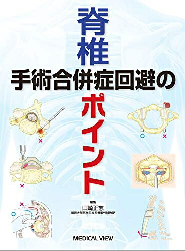 【商品名】脊椎手術 合併症回避のポイント（中古品）中古本の特性上【ヤケ、破れ、折れ、メモ書き、匂い】等がある場合がございます。特に状態が【可】の場合は書き込みや破れがある場合がございますので予めご承知おきのほどよろしくお願いいたします。読む...