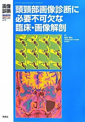 【商品名】画像診断2011年臨時増刊号Vol．31No．11: 頭頸部画像診断に必要不可欠な臨床・画像解剖（中古品）中古本の特性上【ヤケ、破れ、折れ、メモ書き、匂い】等がある場合がございます。特に状態が【可】の場合は書き込みや破れがある場合...