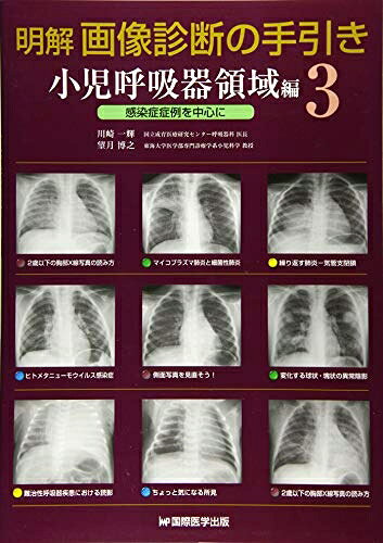 【商品名】明解画像診断の手引き小児呼吸器領域編 (3)（中古品）中古本の特性上【ヤケ、破れ、折れ、メモ書き、匂い】等がある場合がございます。特に状態が【可】の場合は書き込みや破れがある場合がございますので予めご承知おきのほどよろしくお願いい...