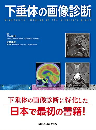【商品名】下垂体の画像診断（中古品）中古本の特性上【ヤケ、破れ、折れ、メモ書き、匂い】等がある場合がございます。特に状態が【可】の場合は書き込みや破れがある場合がございますので予めご承知おきのほどよろしくお願いいたします。読む分には問題ござ...