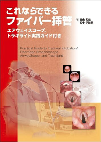 【商品名】これならできるファイバー挿管 -エアウェイスコープ，トラキライト実践ガイド付き-（中古品）中古本の特性上【ヤケ、破れ、折れ、メモ書き、匂い】等がある場合がございます。特に状態が【可】の場合は書き込みや破れがある場合がございますので...