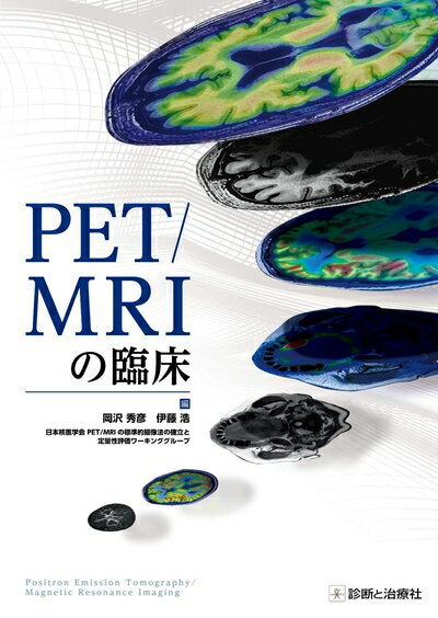 【商品名】PET/MRIの臨床（中古品）中古本の特性上【ヤケ、破れ、折れ、メモ書き、匂い】等がある場合がございます。特に状態が【可】の場合は書き込みや破れがある場合がございますので予めご承知おきのほどよろしくお願いいたします。読む分には問題...