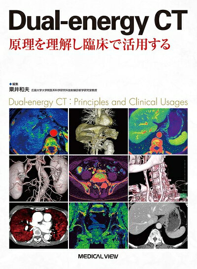 【商品名】Dual-energy CT 原理を理解し臨床で活用する（中古品）中古本の特性上【ヤケ、破れ、折れ、メモ書き、匂い】等がある場合がございます。特に状態が【可】の場合は書き込みや破れがある場合がございますので予めご承知おきのほどよろ...