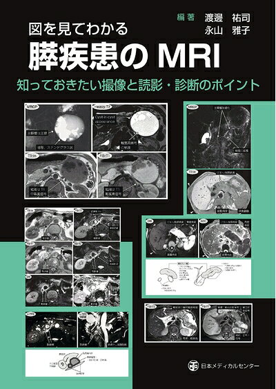 【商品名】図を見てわかる 膵疾患のMRI（中古品）中古本の特性上【ヤケ、破れ、折れ、メモ書き、匂い】等がある場合がございます。特に状態が【可】の場合は書き込みや破れがある場合がございますので予めご承知おきのほどよろしくお願いいたします。読む...