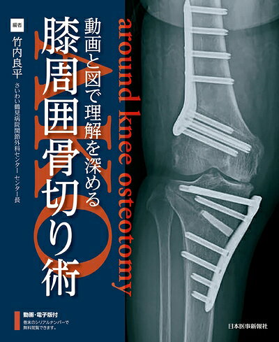 【商品名】膝周囲骨切り術（AKO）- 電子版付 -（中古品）中古本の特性上【ヤケ、破れ、折れ、メモ書き、匂い】等がある場合がございます。特に状態が【可】の場合は書き込みや破れがある場合がございますので予めご承知おきのほどよろしくお願いいたし...