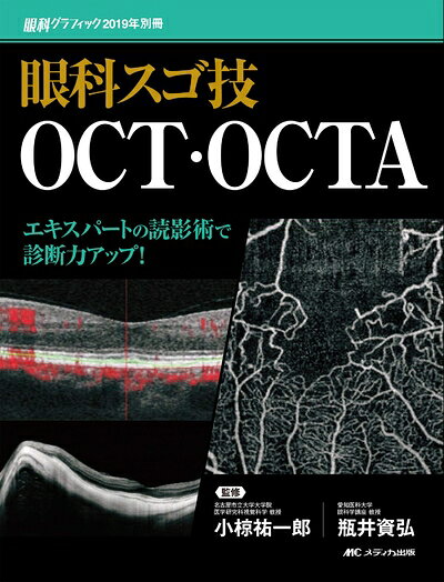 【商品名】眼科スゴ技 OCT・OCTA: エキスパートの読影術で診断力アップ! (眼科グラフィック2019年別冊)（中古品）中古本の特性上【ヤケ、破れ、折れ、メモ書き、匂い】等がある場合がございます。特に状態が【可】の場合は書き込みや破れが...