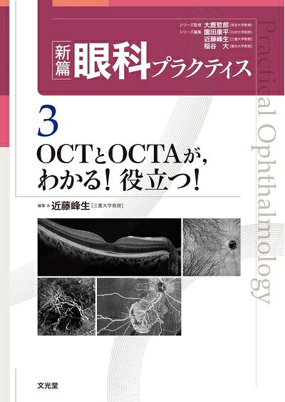 【商品名】OCTとOCTAが,わかる!役立つ! (新篇眼科プラクティス)（中古品）中古本の特性上【ヤケ、破れ、折れ、メモ書き、匂い】等がある場合がございます。特に状態が【可】の場合は書き込みや破れがある場合がございますので予めご承知おきのほ...