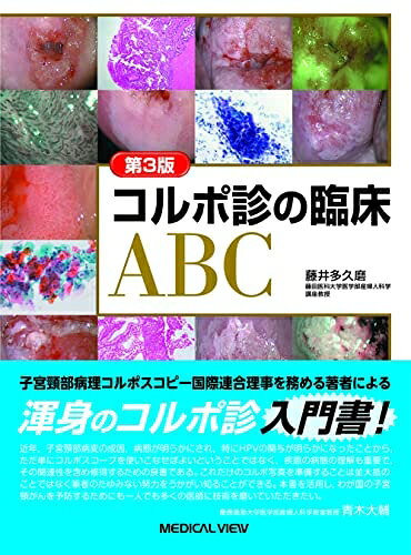 【商品名】コルポ診の臨床ABC−第3版（中古品）中古本の特性上【ヤケ、破れ、折れ、メモ書き、匂い】等がある場合がございます。特に状態が【可】の場合は書き込みや破れがある場合がございますので予めご承知おきのほどよろしくお願いいたします。読む分...