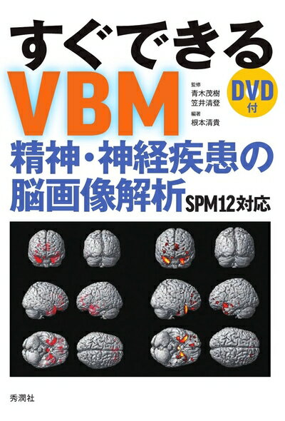 【商品名】すぐできるVBM: 精神・神経疾患の脳画像解析 SPM12対応 DVD付（中古品）中古本の特性上【ヤケ、破れ、折れ、メモ書き、匂い】等がある場合がございます。特に状態が【可】の場合は書き込みや破れがある場合がございますので予めご承...