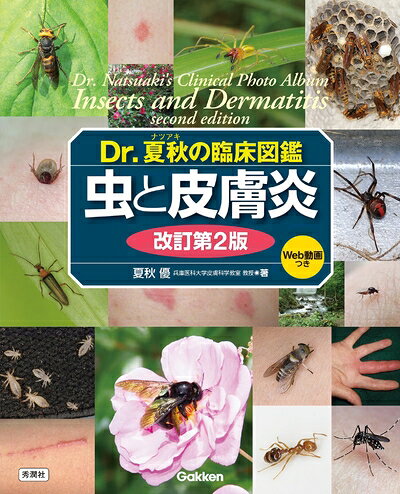 【商品名】Dr.夏秋の臨床図鑑 虫と皮膚炎 改訂第2版（中古品）中古本の特性上【ヤケ、破れ、折れ、メモ書き、匂い】等がある場合がございます。特に状態が【可】の場合は書き込みや破れがある場合がございますので予めご承知おきのほどよろしくお願いい...