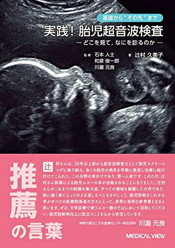 【商品名】実践! 胎児超音波検査 ーどこを見て,なにを診るのか?（中古品）中古本の特性上【ヤケ、破れ、折れ、メモ書き、匂い】等がある場合がございます。特に状態が【可】の場合は書き込みや破れがある場合がございますので予めご承知おきのほどよろし...